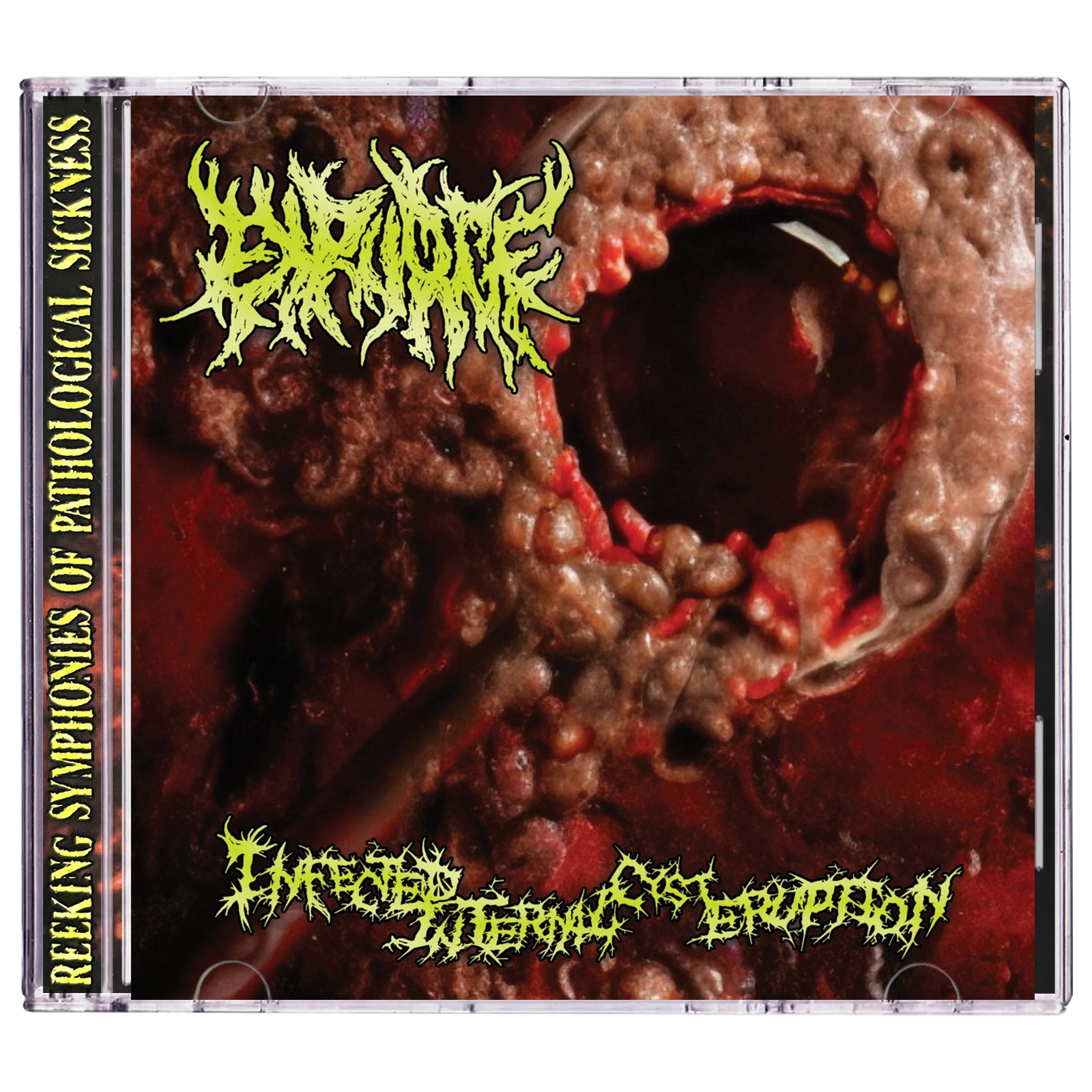 Expurge 'Infected Internal Cyst Eruption' CD – Reality Fade Merch