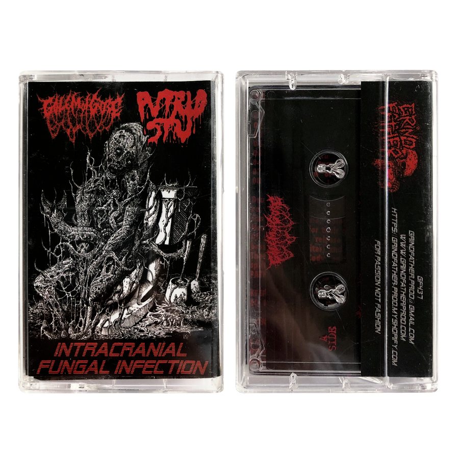 Golem Of Gore / Putrid Stu 'Intracranial Fungal Infection (Split)' Cas ...